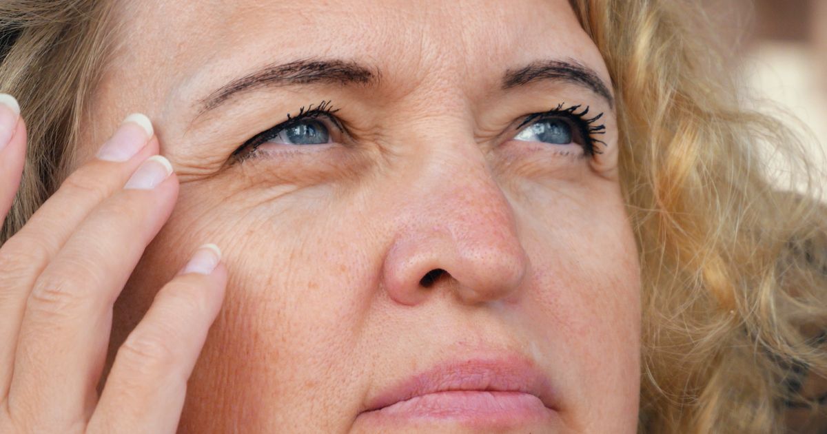 Vaeltelevia roskia näkökentässä? Kyseessä voi olla lasiaisen irtauma ...